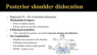 SHOULDER DISLOCATION - Types, Clinical Features | PPTX