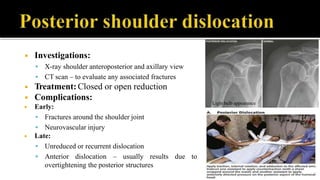 SHOULDER DISLOCATION - Types, Clinical Features | PPTX