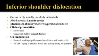 SHOULDER DISLOCATION - Types, Clinical Features | PPTX