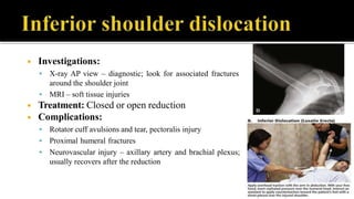 SHOULDER DISLOCATION - Types, Clinical Features | PPTX