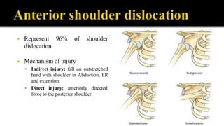 SHOULDER DISLOCATION - Types, Clinical Features | PPTX