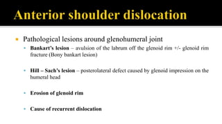 shoulder dislocation and its treatment .pptx