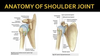 shoulder dislocation and its treatment .pptx