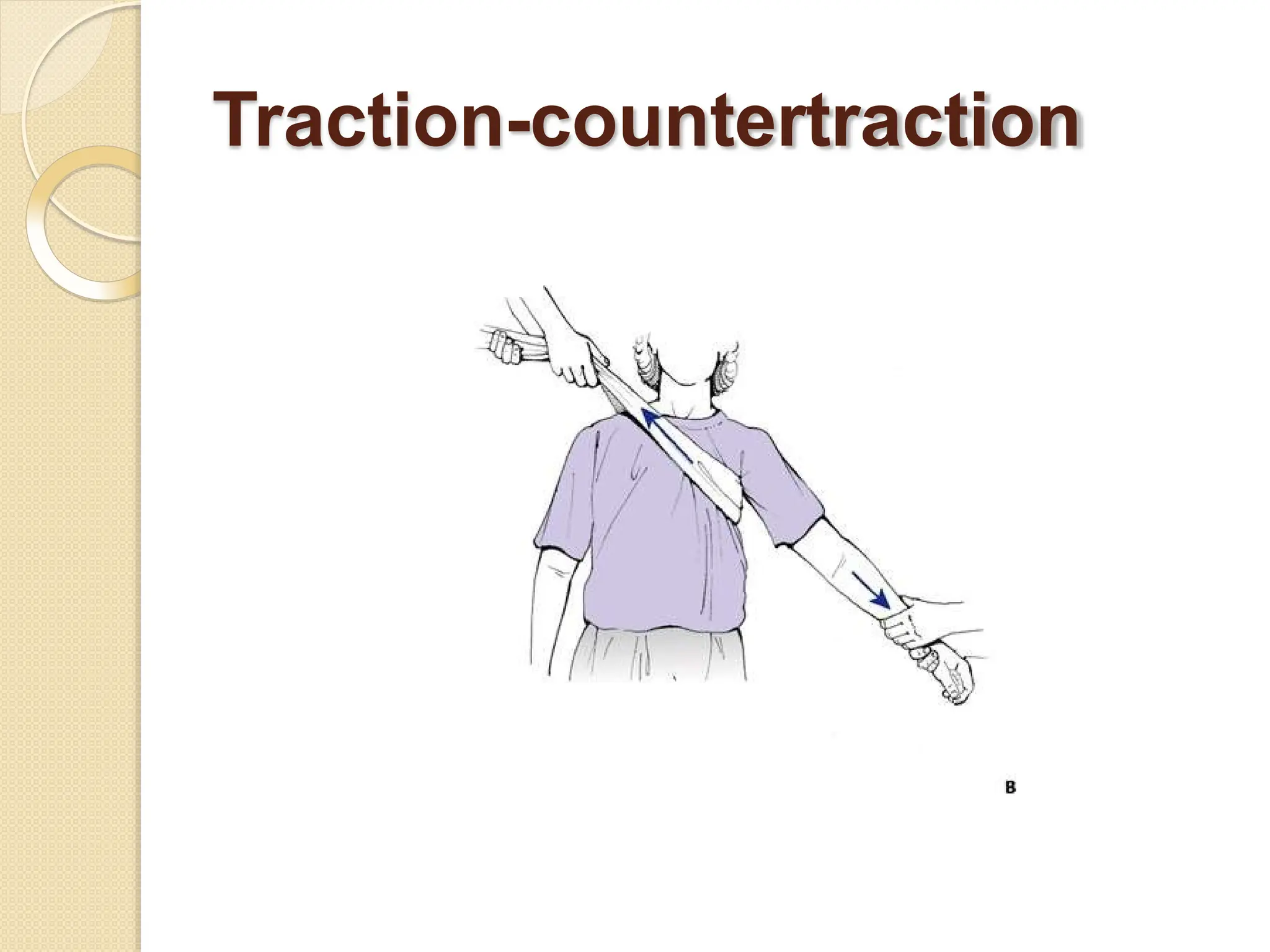 Shoulder Dislocation.pptx subject traumatology | PPTX