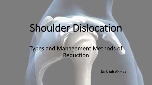 Shoulder dislocation: Types and Management Methods of Reduction | PPTX
