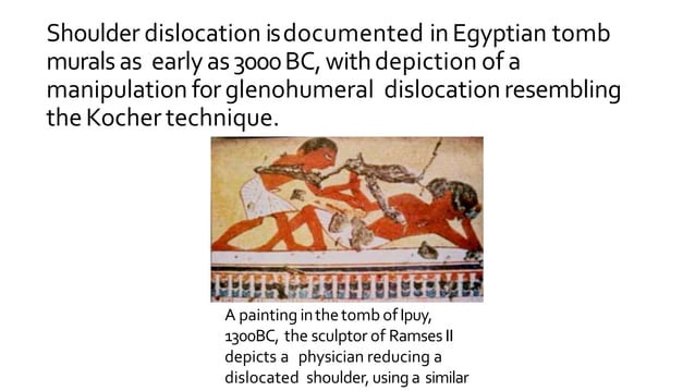 Shoulder dislocation: Types and Management Methods of Reduction | PPTX