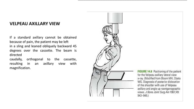Shoulder dislocation: Types and Management Methods of Reduction | PPTX