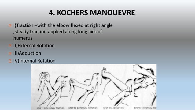 Shoulder dislocation: Types and Management Methods of Reduction | PPTX