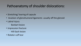 Shoulder dislocation: Types and Management Methods of Reduction | PPTX