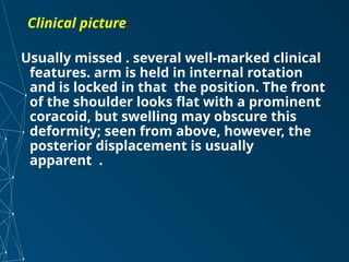 shoulder dislocation orthopaedic alqadih.pptx