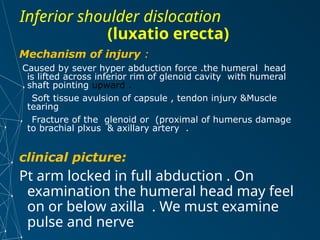 shoulder dislocation orthopaedic alqadih.pptx
