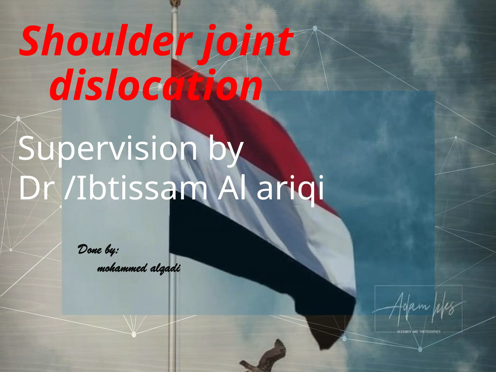 shoulder dislocation by Mohammed alqadi_١٠٤٢١٩.pptx