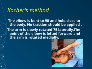 shoulder dislocation by Mohammed alqadi_١٠٤٢١٩.pptx