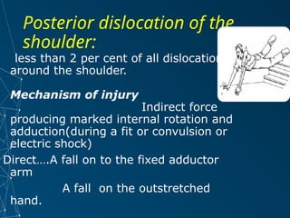 shoulder dislocation by Mohammed alqadi_١٠٤٢١٩.pptx
