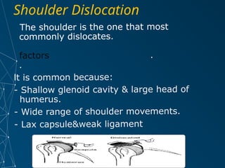 shoulder dislocation by Mohammed alqadi_١٠٤٢١٩.pptx