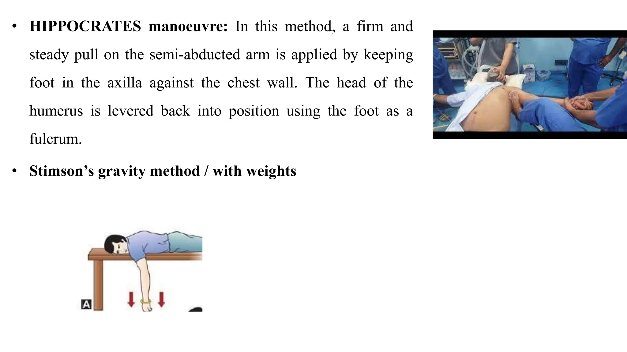 Shoulder dislocations - orthopedics.pptx