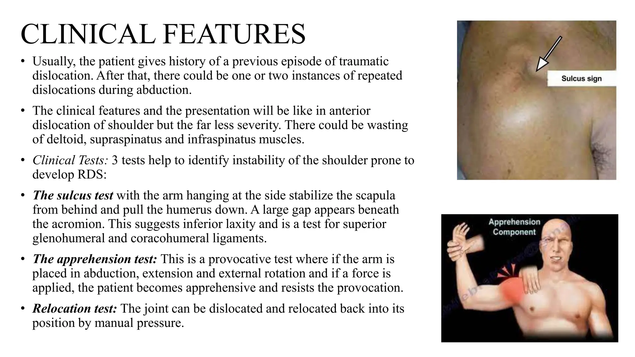 Shoulder dislocations - orthopedics.pptx