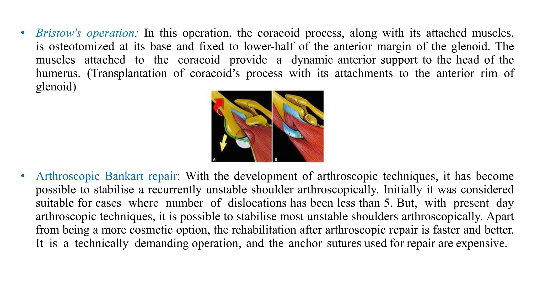 Shoulder dislocations - orthopedics.pptx