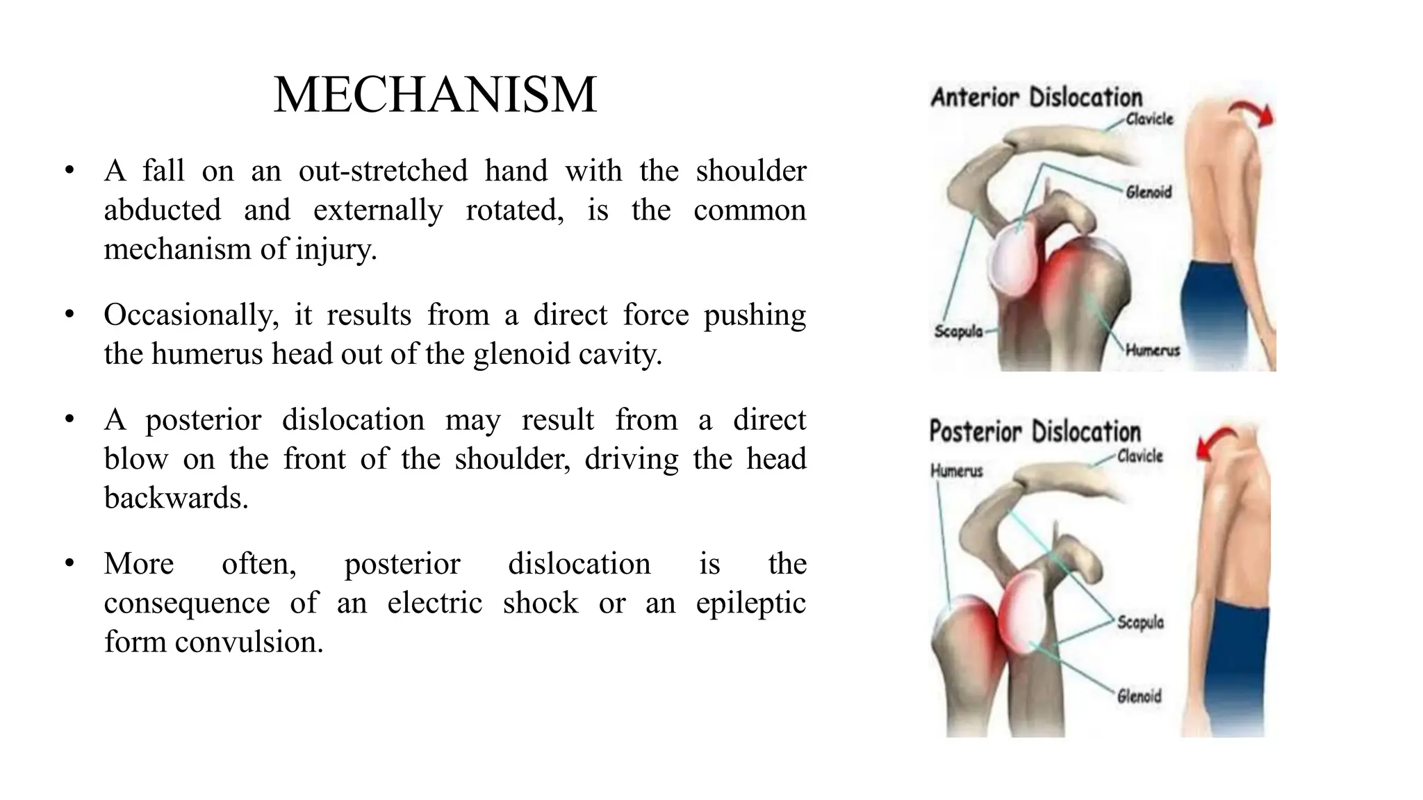 Shoulder dislocations - orthopedics.pptx