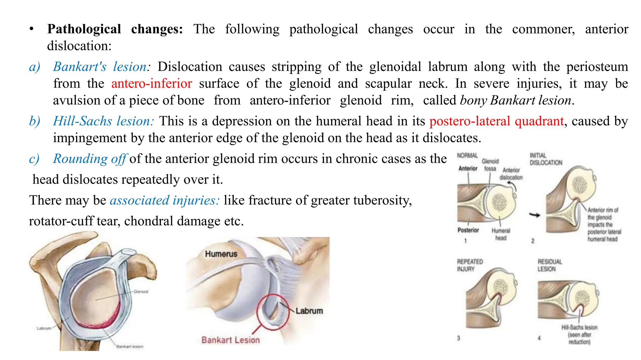 Shoulder dislocations - orthopedics.pptx
