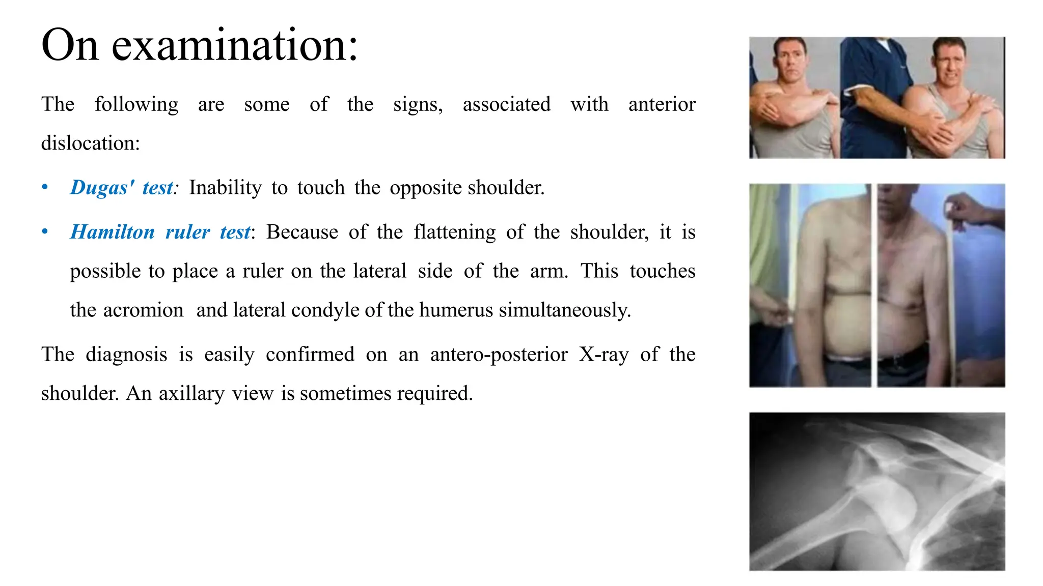Shoulder dislocations - orthopedics.pptx