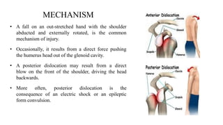 Shoulder dislocations - orthopedics.pptx