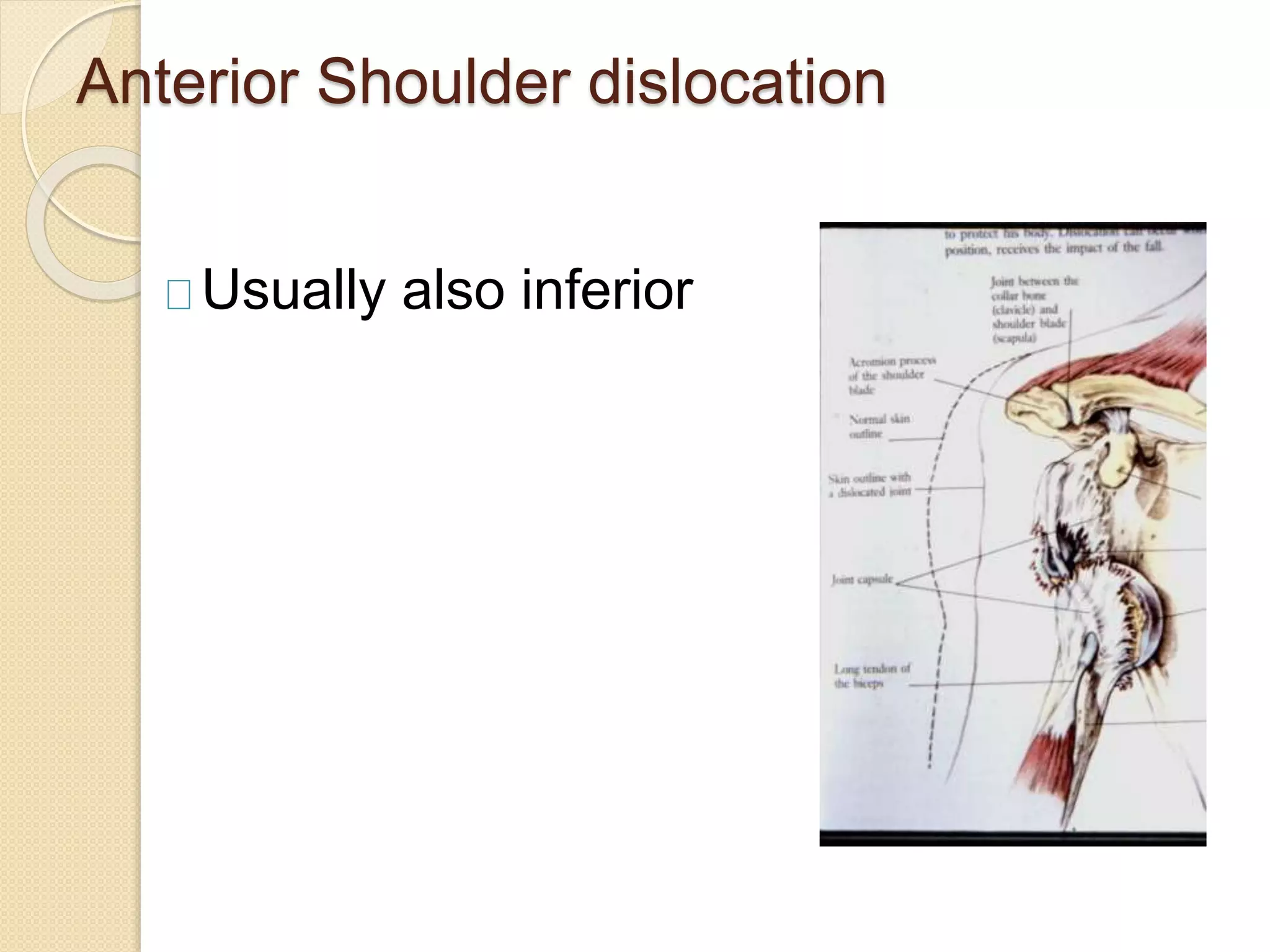 Shoulder Dislocation Saseendar Ppsx
