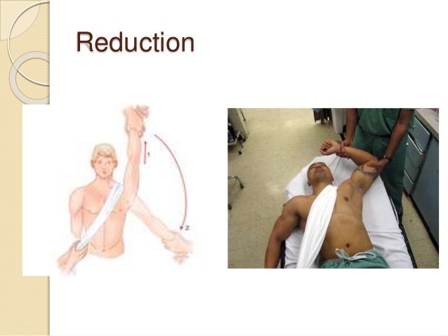 Shoulder dislocation Saseendar