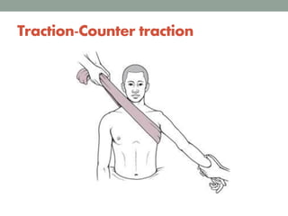 Shoulderdislo kan | PPT