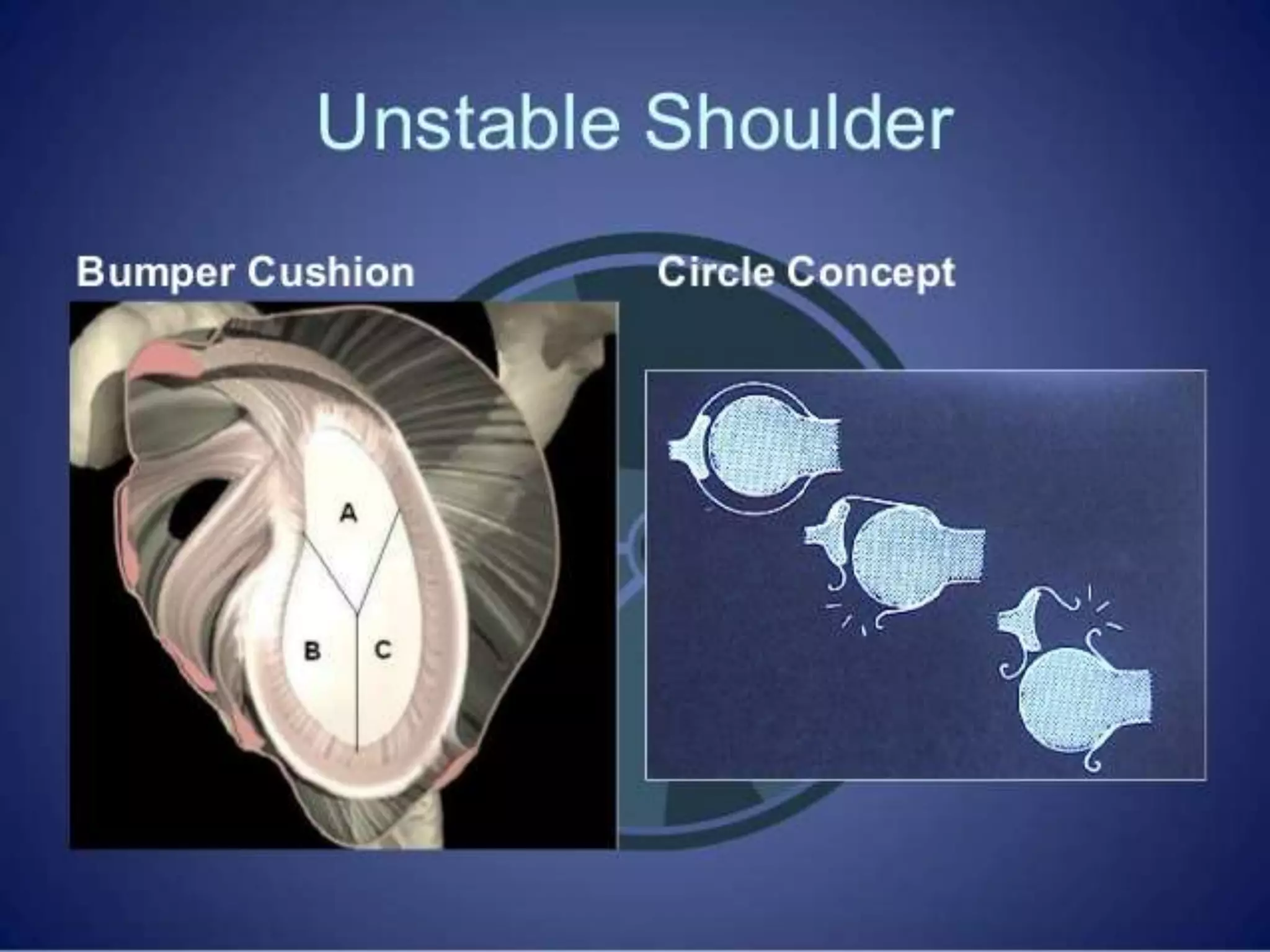 shoulder dislocationcation | PPT