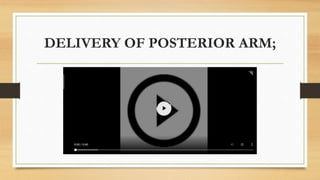 Shoulder dystocia by dr salma khwaga jaan | PPT