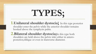 Shoulder dystocia by dr salma khwaga jaan | PPTX