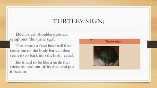 Shoulder dystocia by dr salma khwaga jaan | PPT