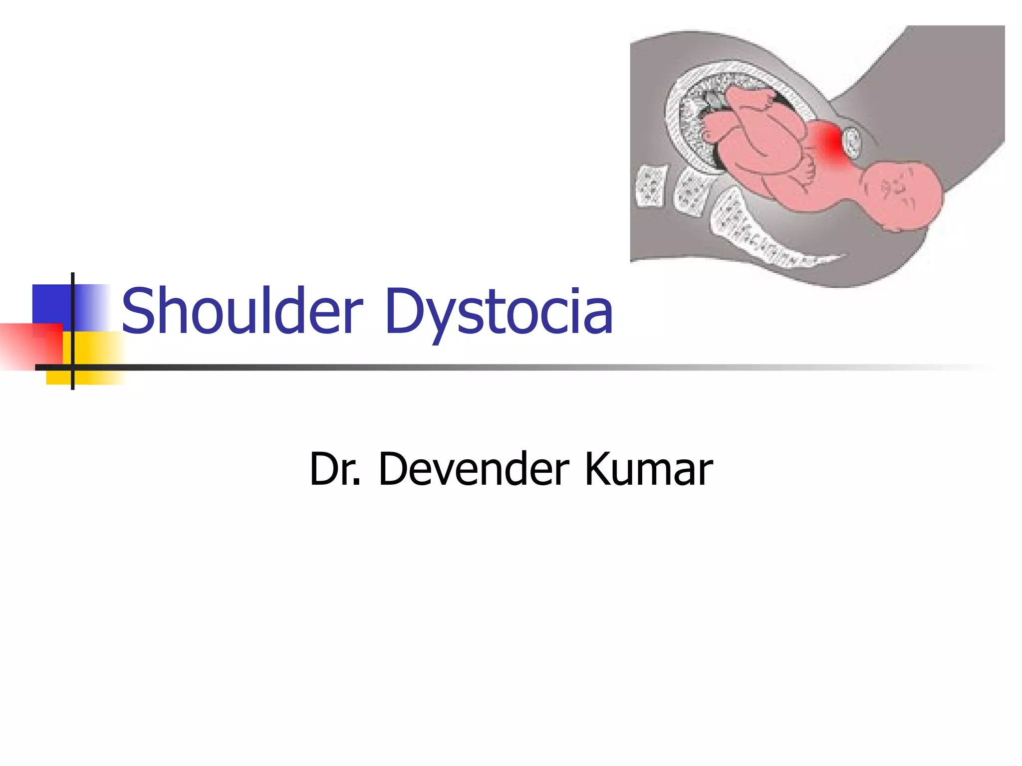 Shoulder Dystocia | PPT