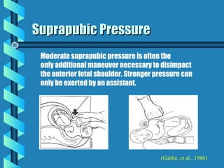 Suprapubic Pressure
