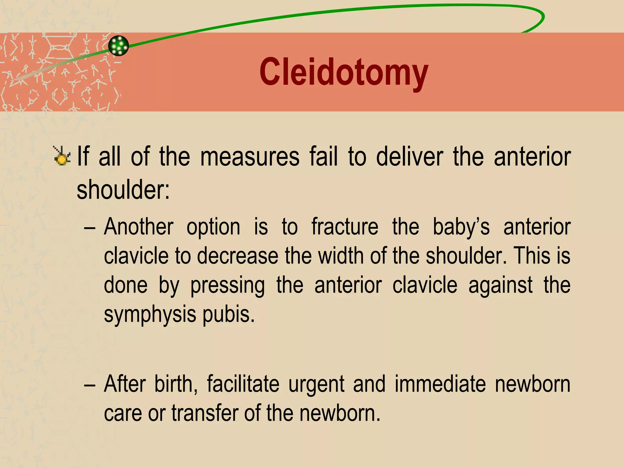 Shoulder dystocia | PPTX