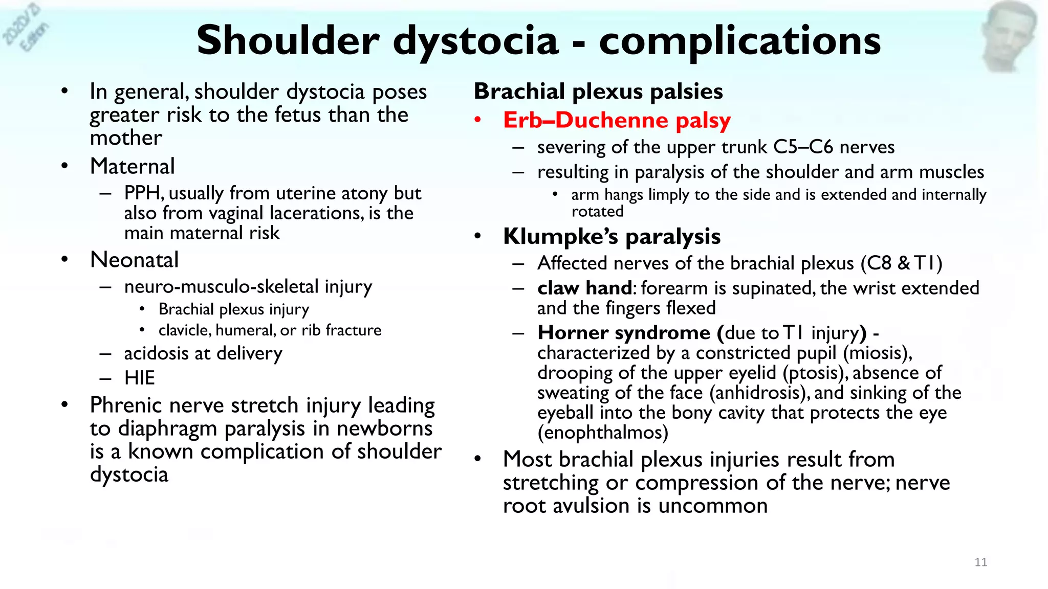 Shoulder dystocia 2021 | PDF