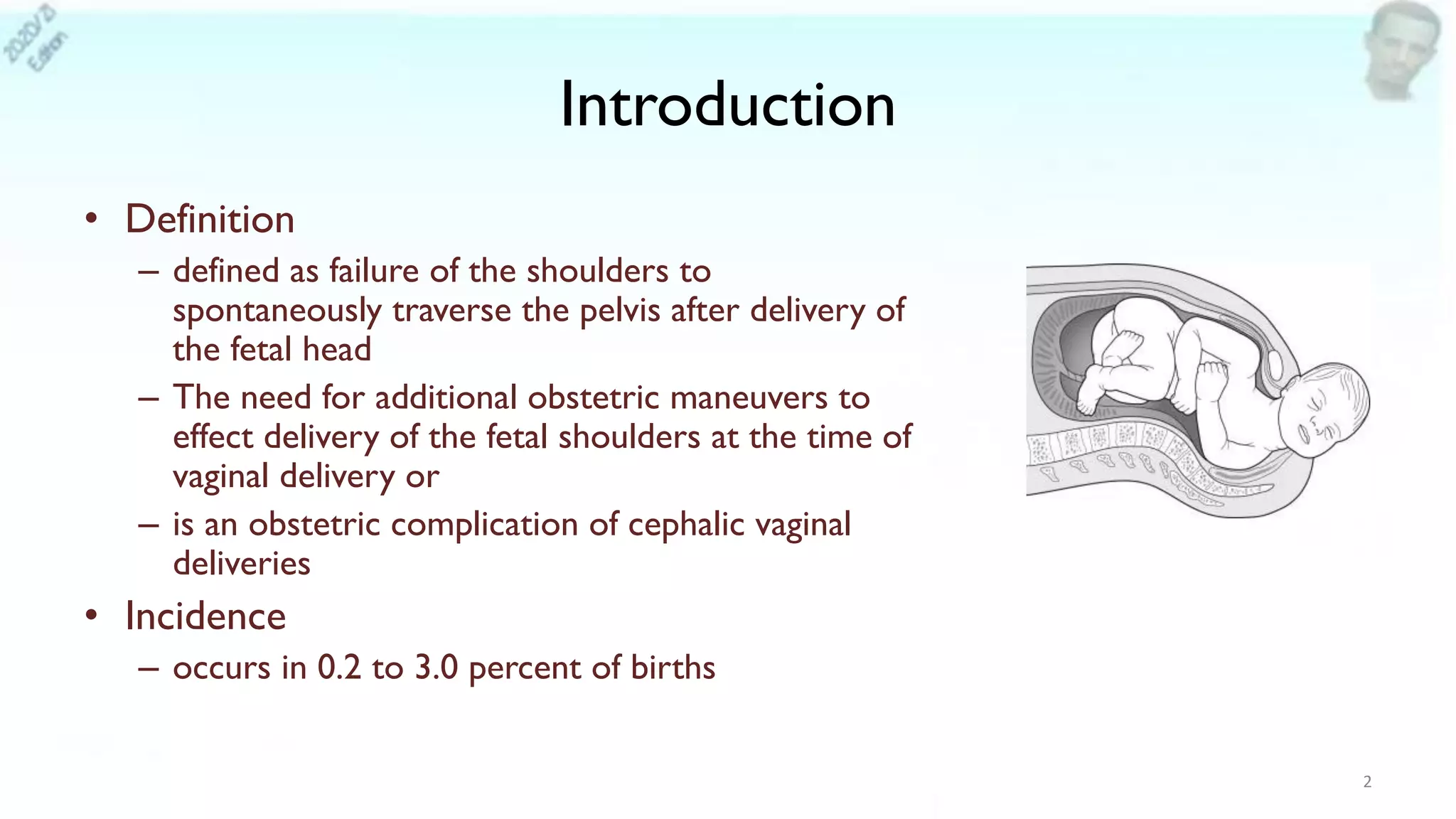 Shoulder dystocia 2021 | PDF
