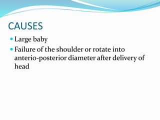 Shoulder dystocia | PPTX