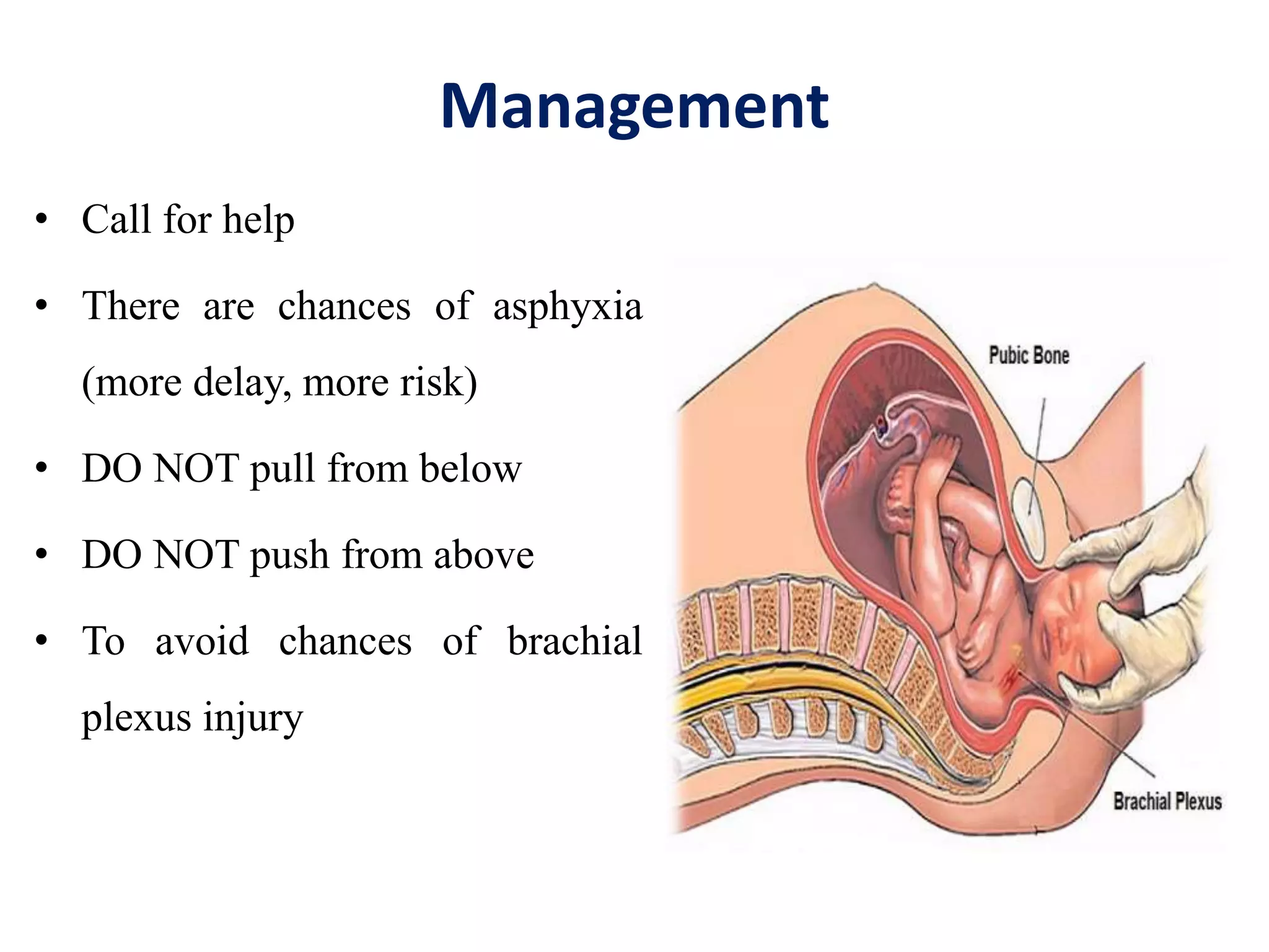 Shoulder dystocia.pptx