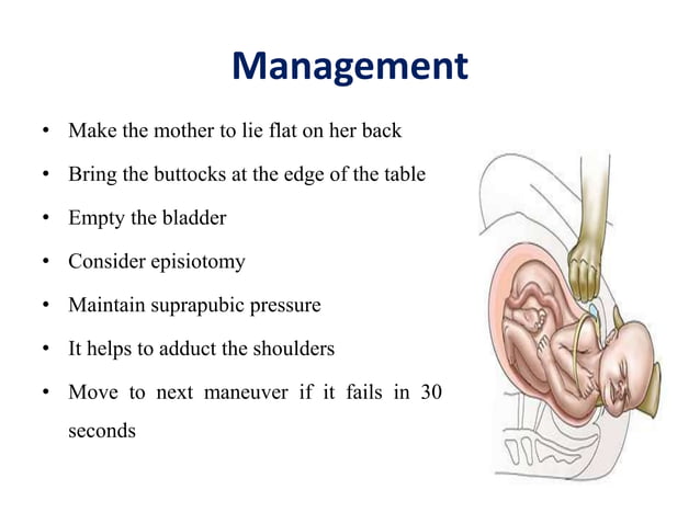 Shoulder dystocia.pptx