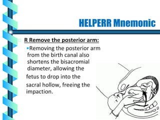 Shoulder dystocia.pdf