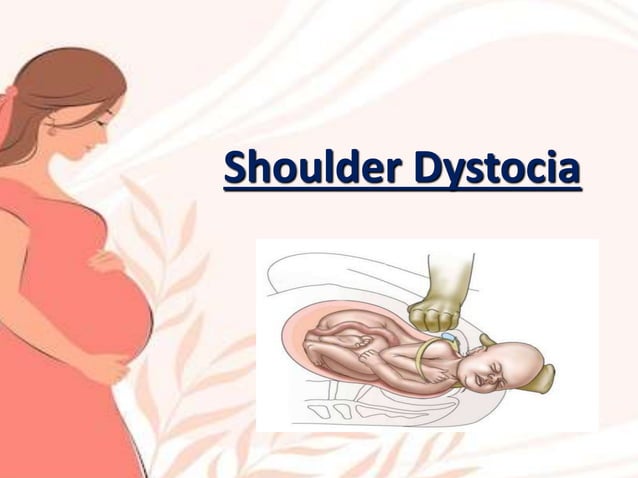 shoulder Dystocia.pptx | Pregnancy | Reproductive Health