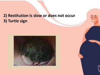 shoulder Dystocia.pptx