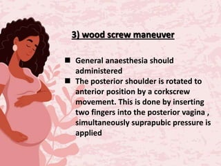 shoulder Dystocia.pptx