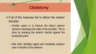 Shoulder_dystocia.pptx ( complications of delivery ,) | PPTX