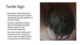 shoulder dystaaaaaaaaaaaaaaaaaaocia.pptx