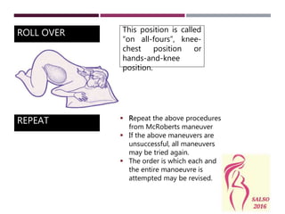 Shoulder dystocia 2016 | PPTX