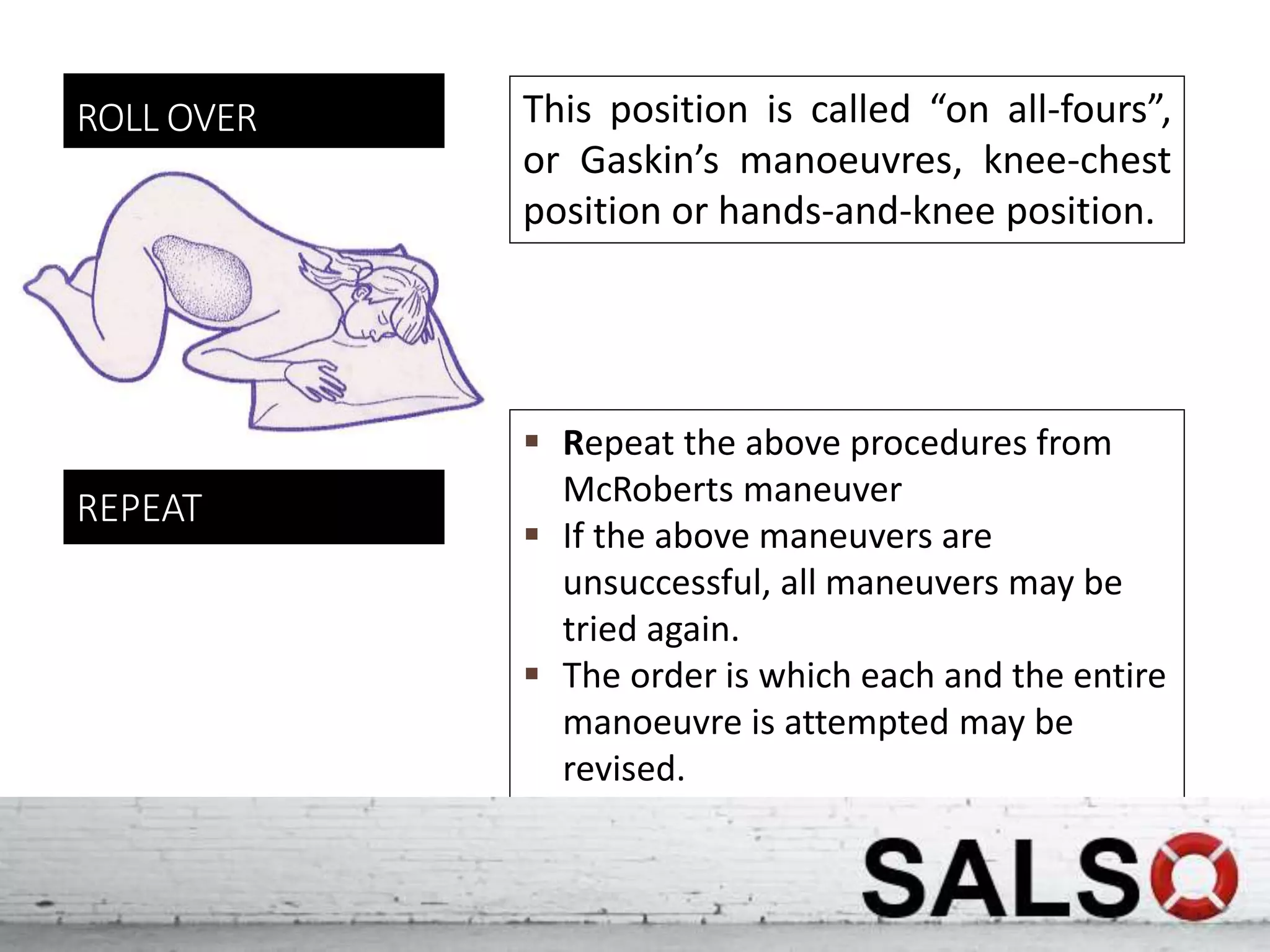 Shoulder Dystocia 2018 | PPTX