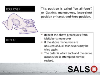 Shoulder Dystocia 2018 | PPTX